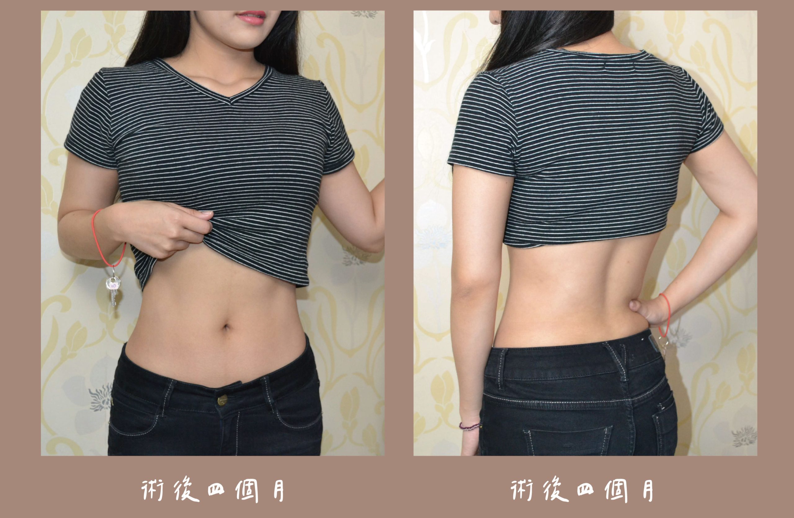 音浪脂雕|完美塑造激腰瘦鉛筆腿-MS.Qin - 新顏診所